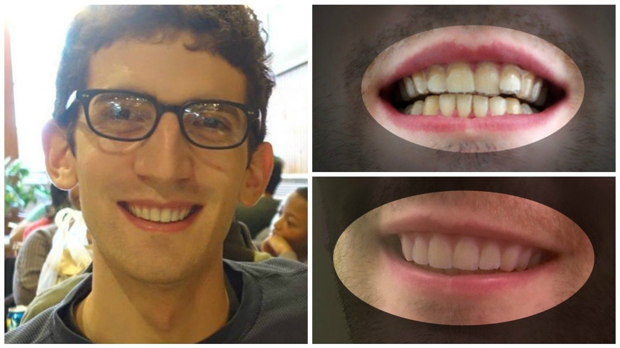 Dantis išsitiesino namie: prireikė vos 50 eurų - Delfi sveikata