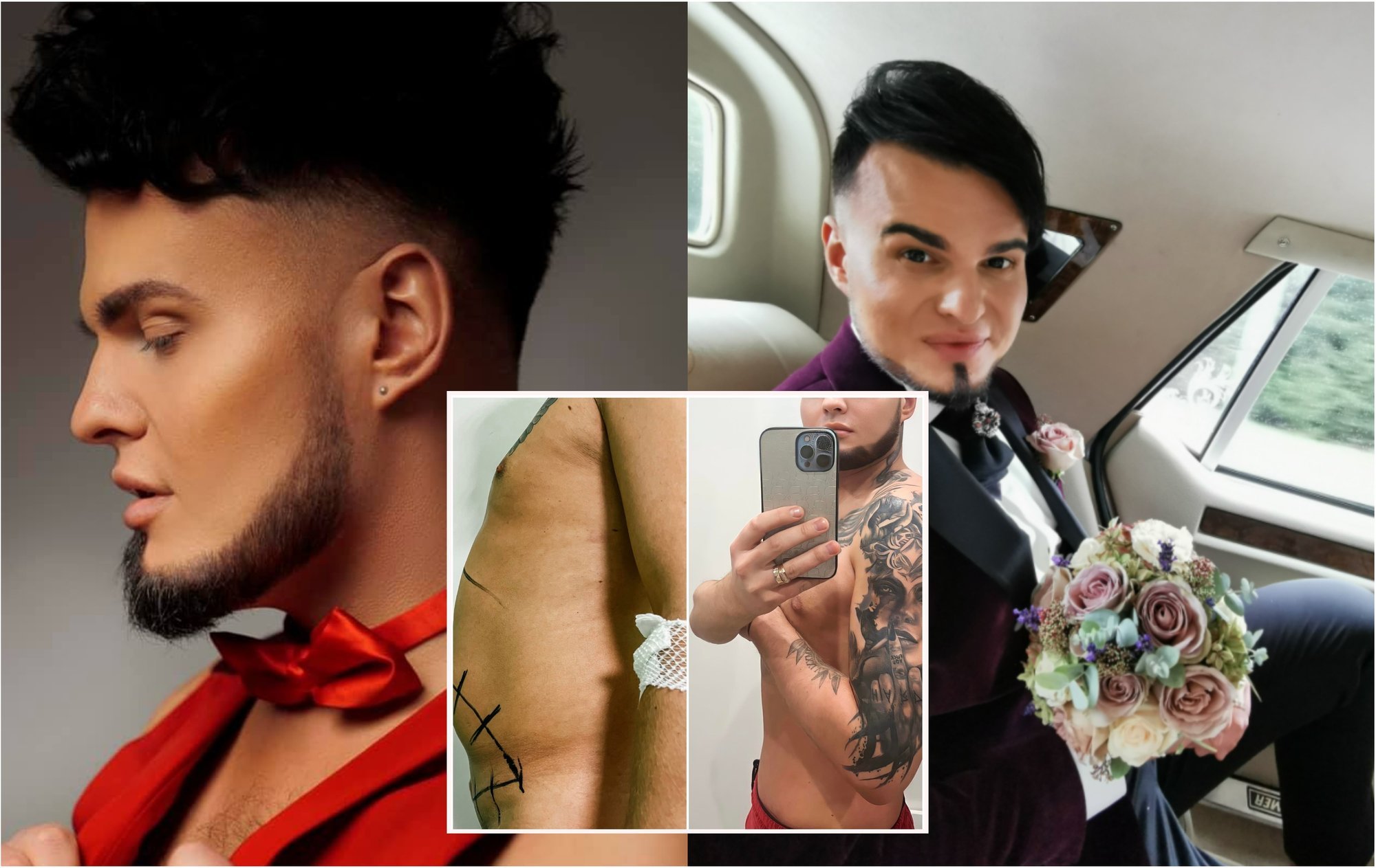 Vytenis Partikas džiaugiasi atlikta riebalų pašalinimo operacija ...