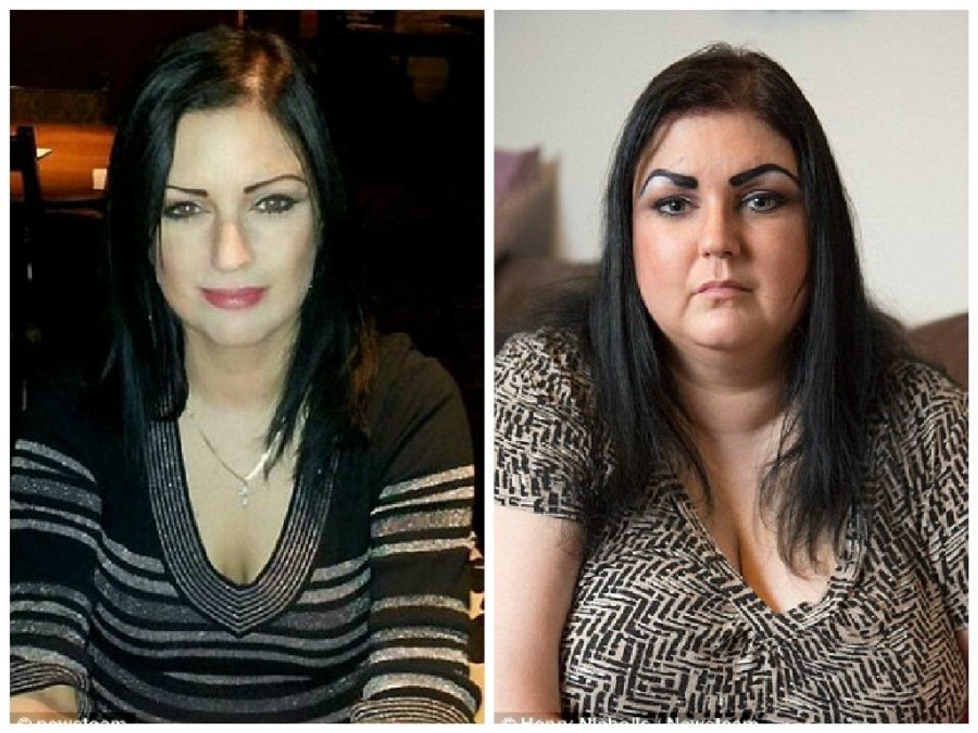 Dėl paslaptingos ligos britės svoris padvigubėjo - Delfi sveikata