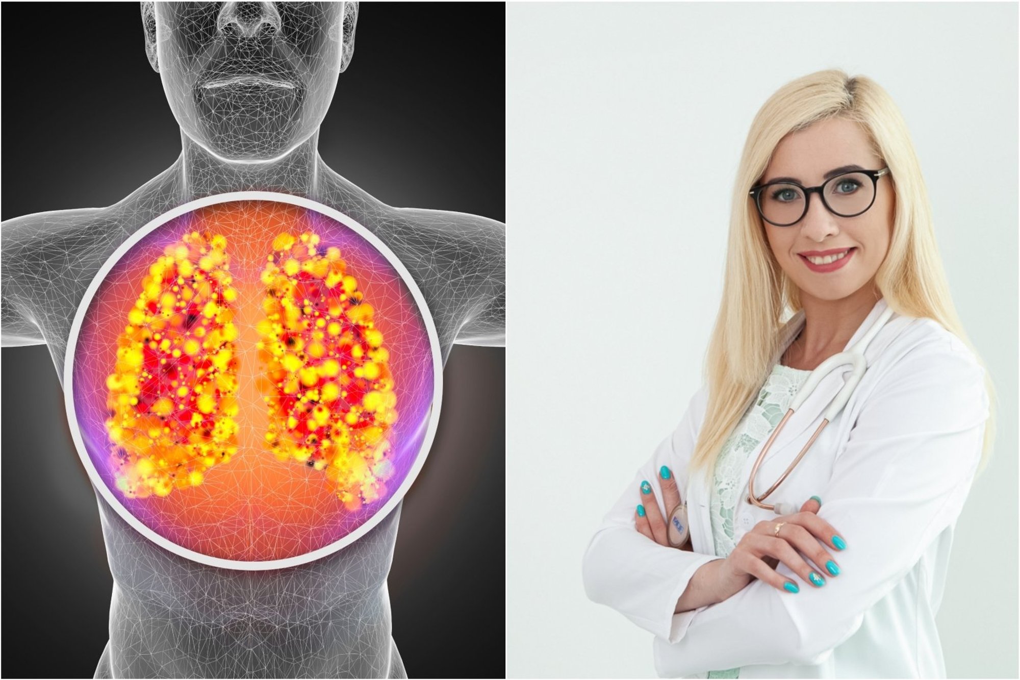 Požymiai, pagal kuriuos galima įtarti plaučių uždegimą: vyresni žmonės ...