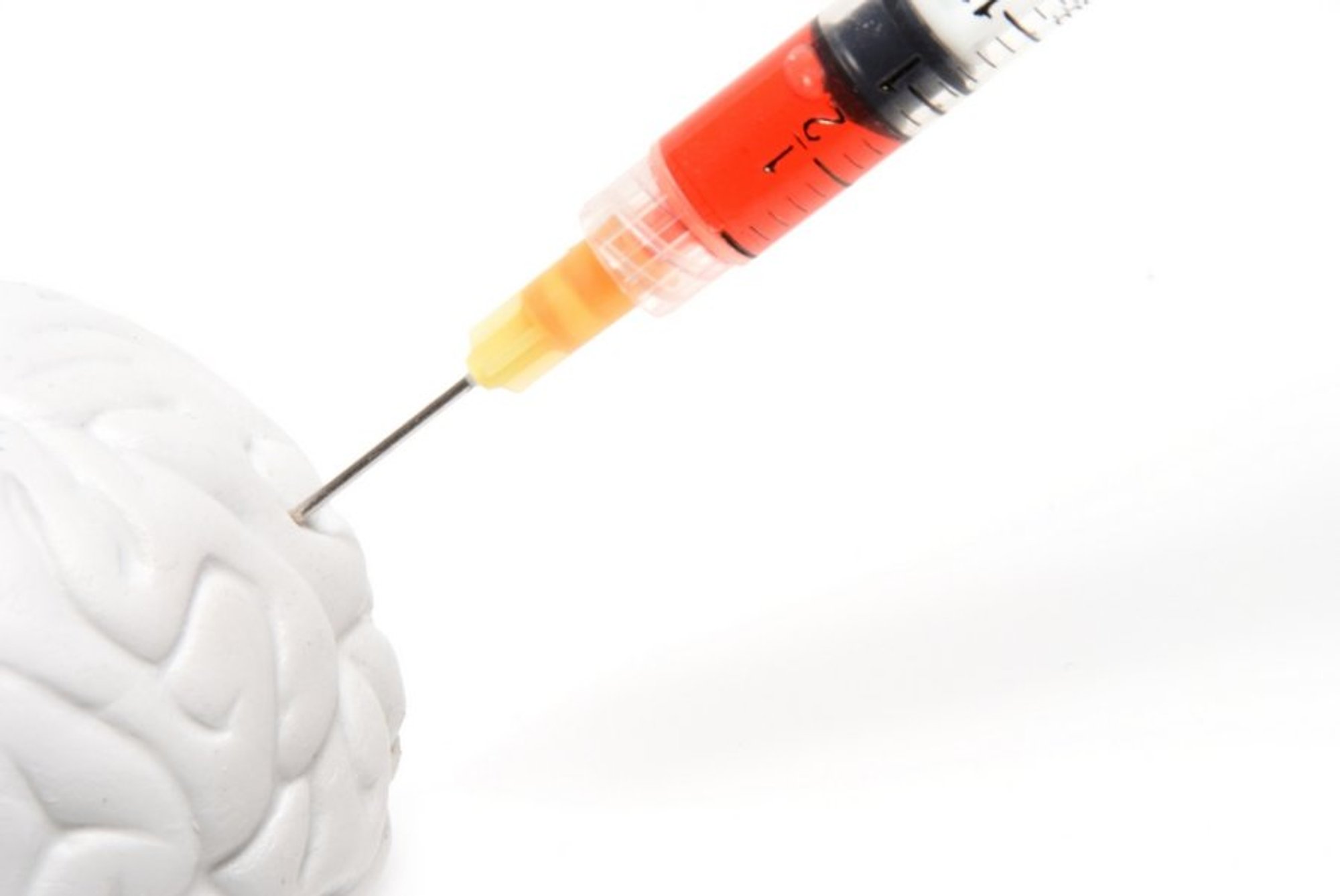 Meluoja, kad 5G „padaro“ lobotomiją - Delfi