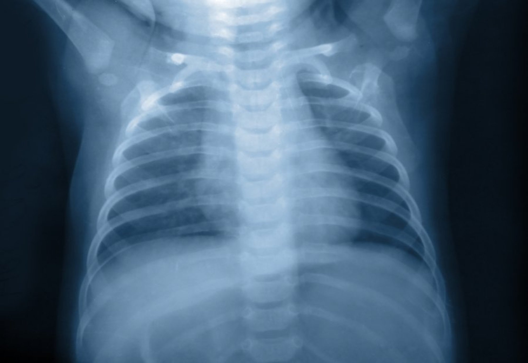 Rentgenografija – vis dar populiariausias diagnostinis tyrimas ...