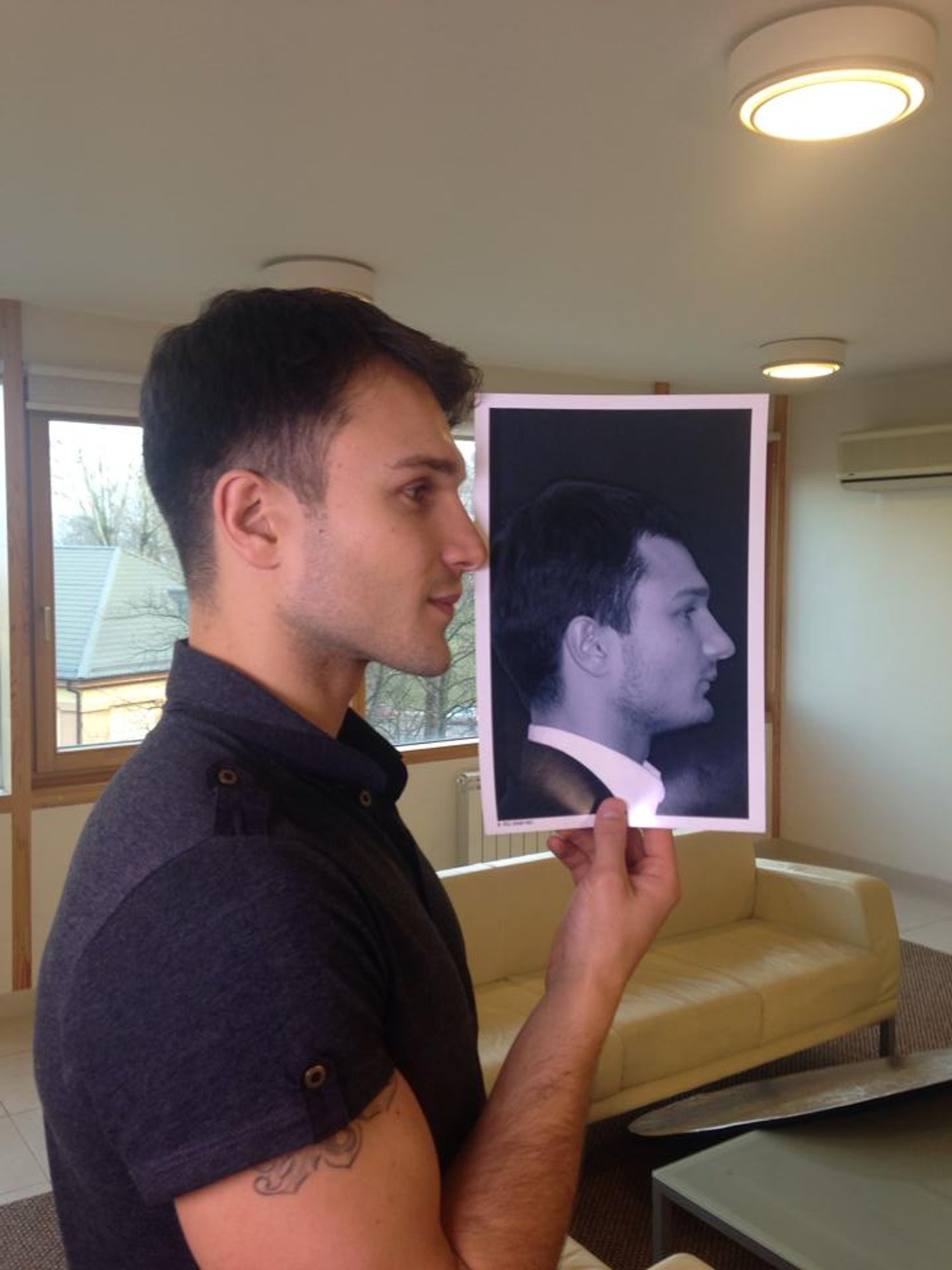 V. Baumila: žandikaulio operacijos radikaliai pakeičia išvaizdą - Delfi ...