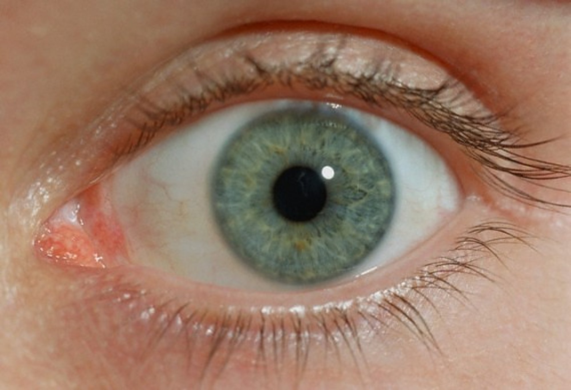 Dirbtinės ragenos persodinimo metodas pasirodė sėkmingas - Delfi gyvenimas