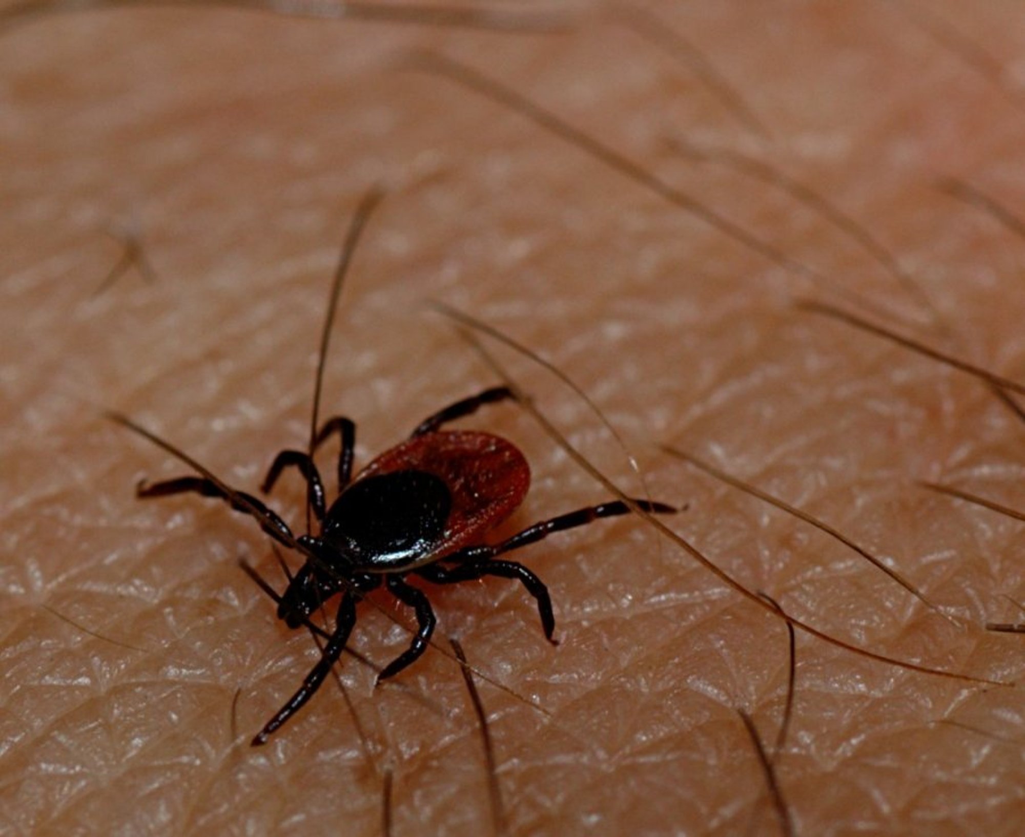 Kaip teisingai ištraukti erkę - Delfi sveikata