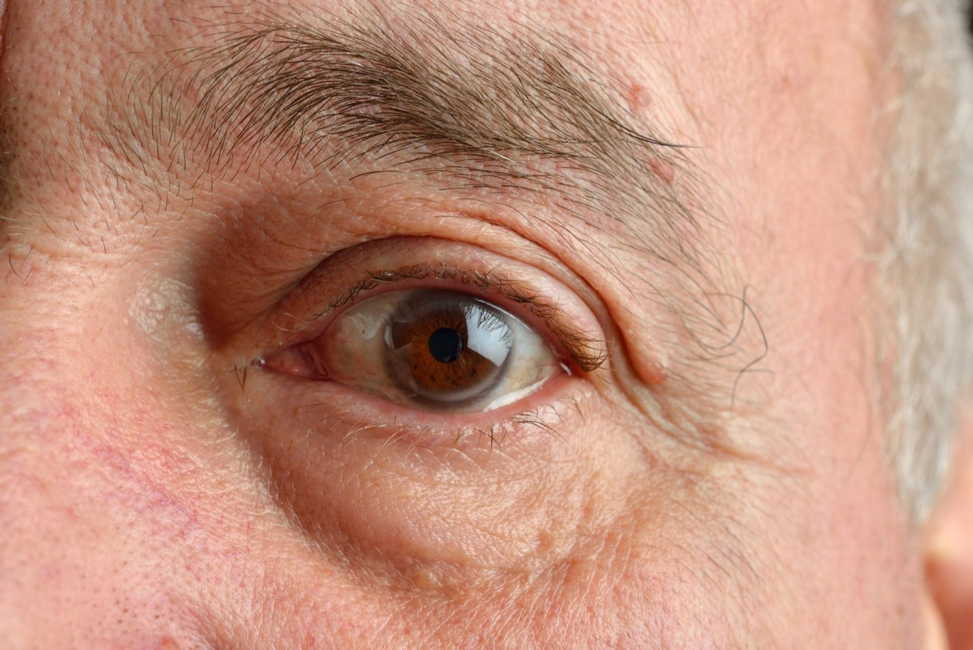 Svarbiausios taisyklės, kaip prižiūrėti akis vasarą: apsaugos ir nuo ...