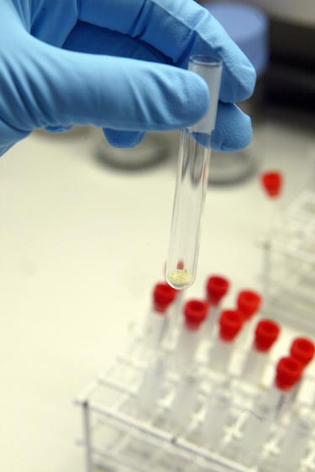 "Fermentas" dalyvaus 10 mln. eurų vertės projekte - Delfi mokslas