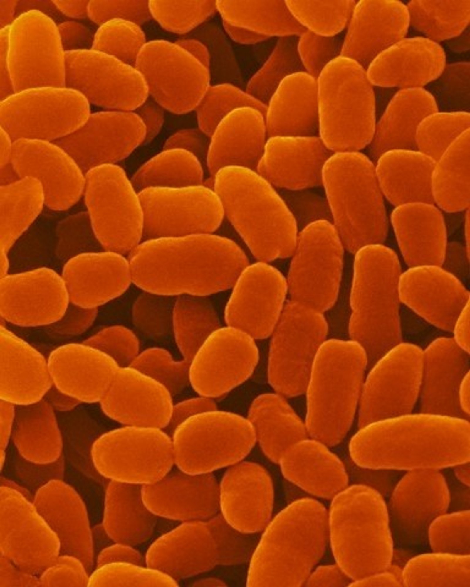 Hepatitas E - nauja infekcinė liga - Delfi gyvenimas