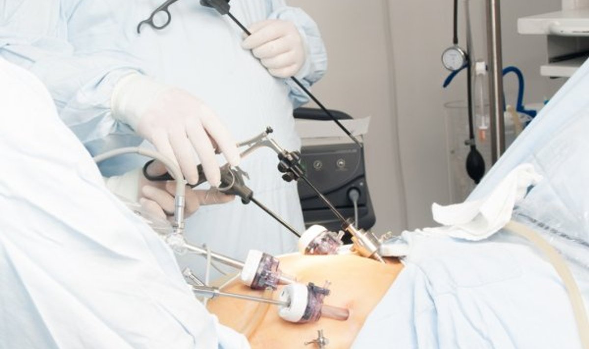 Ligoninė turi gerą žinią: nutukimo operacijos pacientams nieko ...