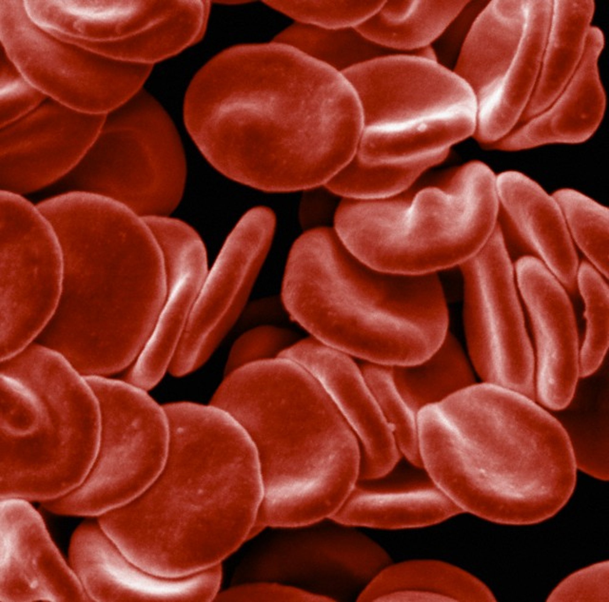 Infarktų ir insultų tikimybę tikimasi mažinti magnetais - Delfi mokslas