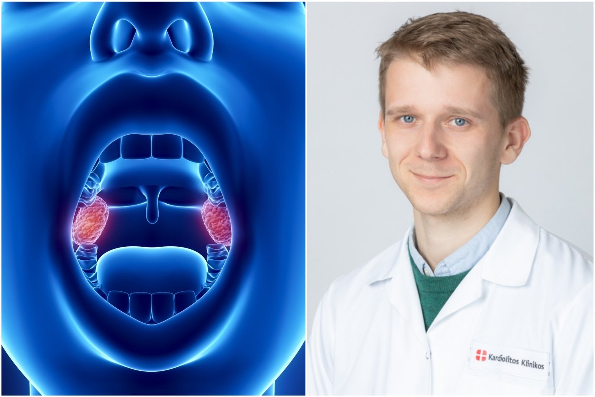 Gydytojas išvardijo 3 priežastis, kada tonziles šalinti būtina - Delfi ...
