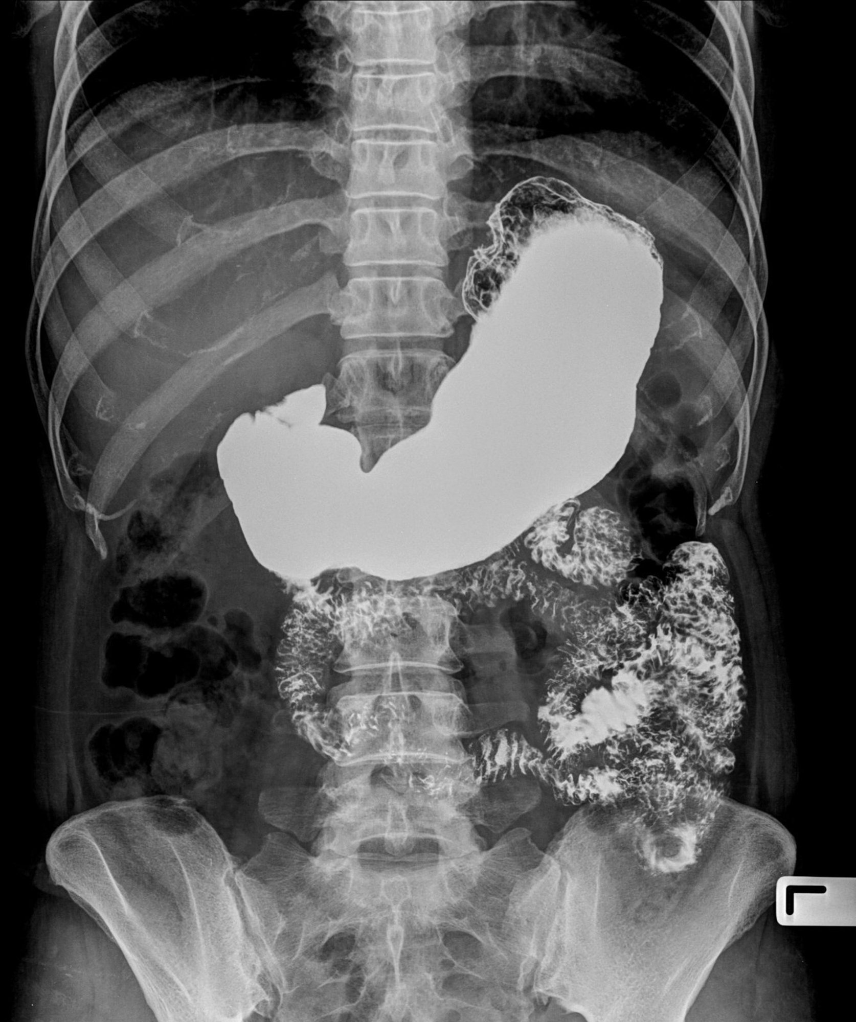 Klaipėdos chirurgai atliko protu sunkiai suvokiamą operaciją - Delfi ...