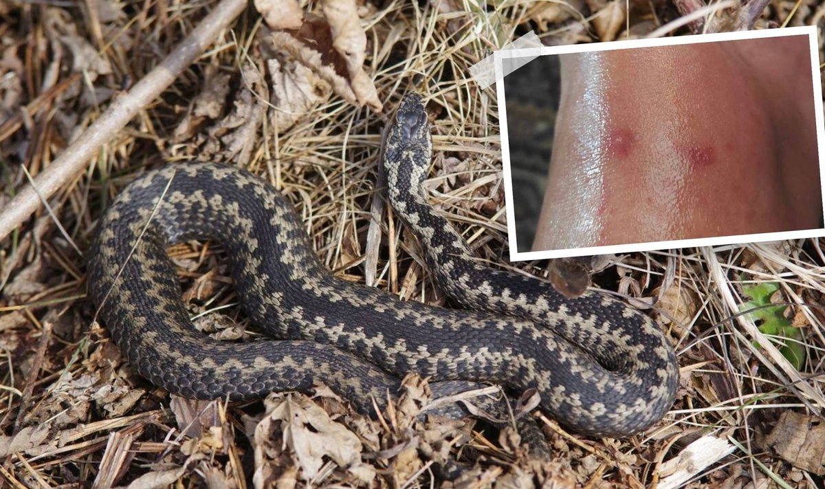 Gyvatės įkandimas: simptomai ir gydymas - Delfi grynas