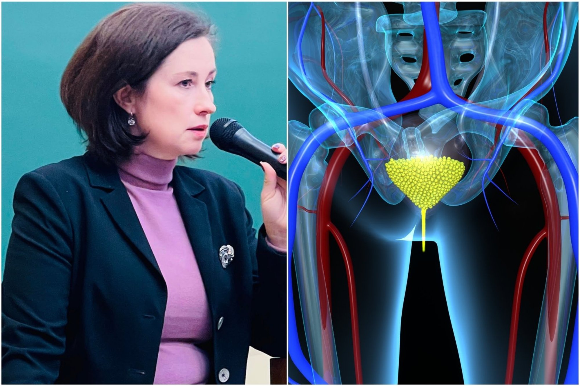 Šlapimo nelaikymas – dažna liga, kurią norisi nuslėpti: gydytoja patarė ...