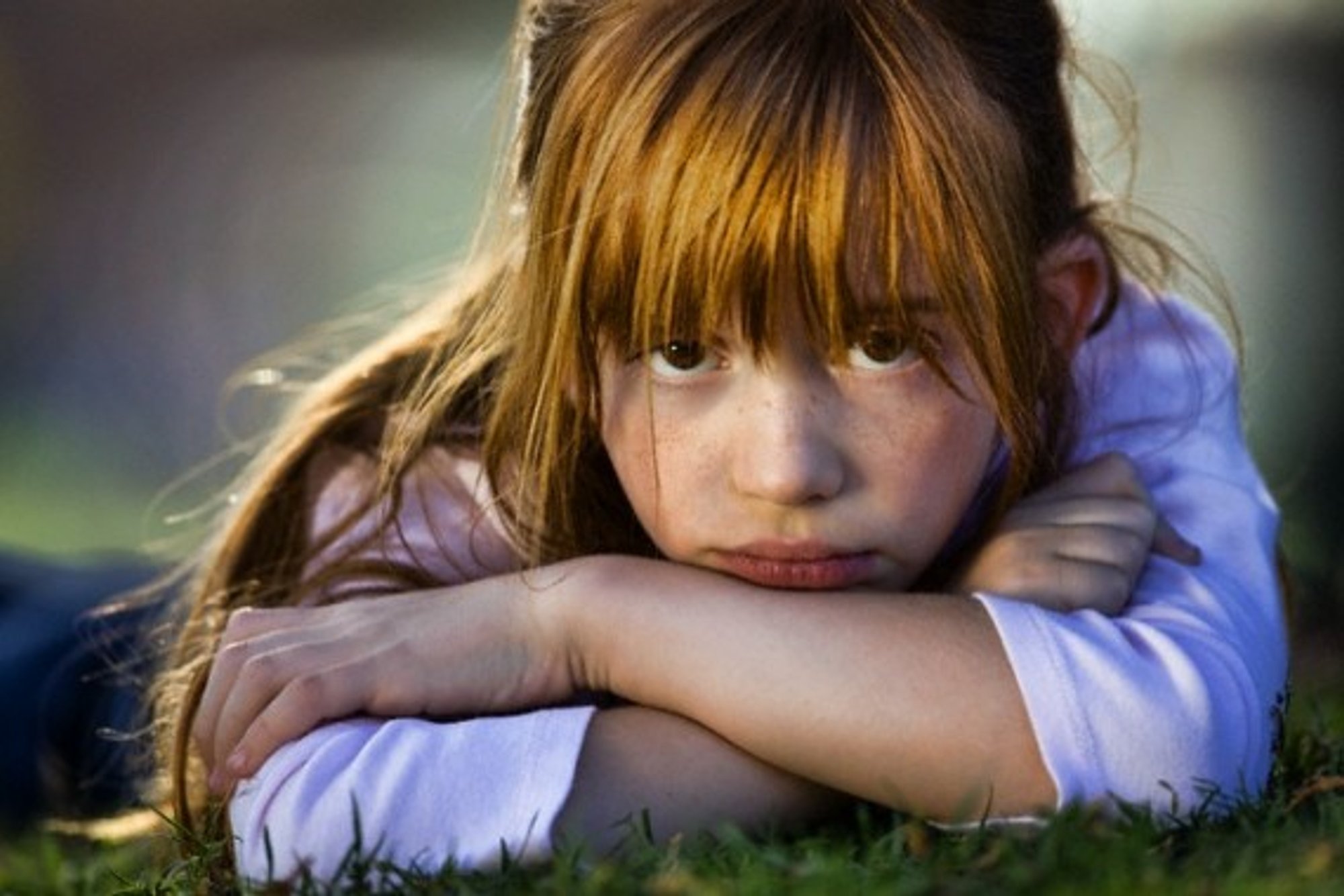 Žvynuota mergaitė nori užaugti kaip visi - Delfi gyvenimas