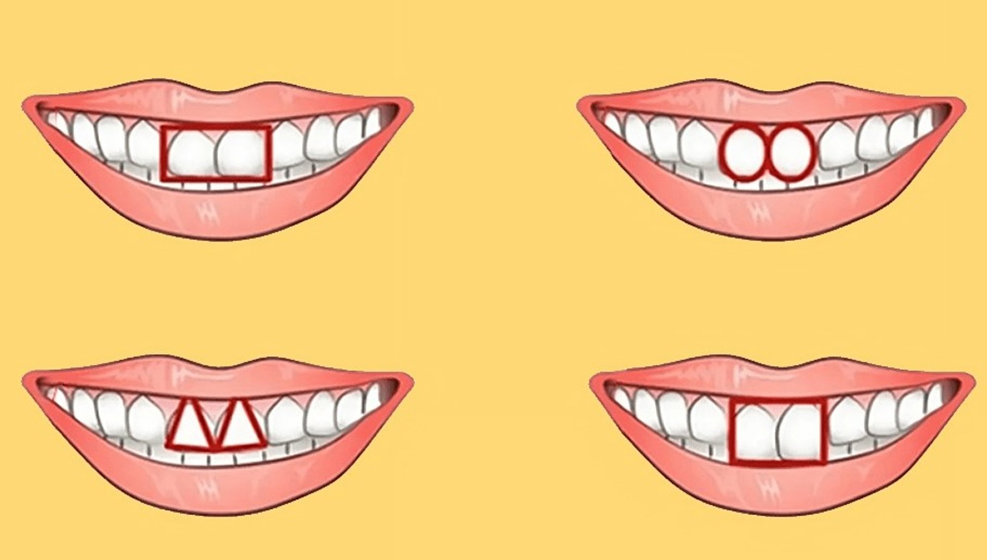 Įdomus testas: kaip nustatyti žmogaus charakterį pagal jo dantis ...