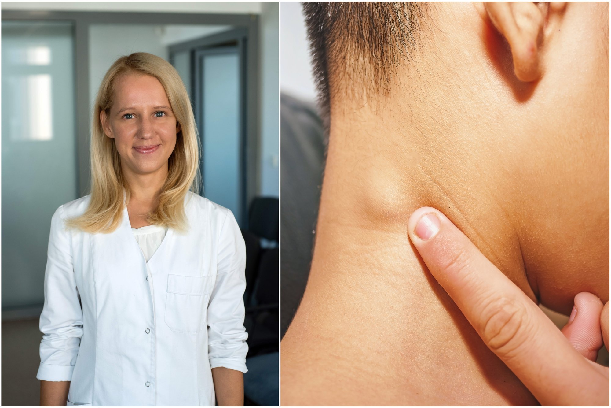 Padidėjo limfmazgiai: kada reikia sunerimti ir įtarti vėžį - Delfi ...