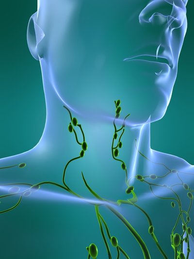 10 veiksmingų būdų, kaip išvalyti limfą nuo toksinų - Delfi gyvenimas