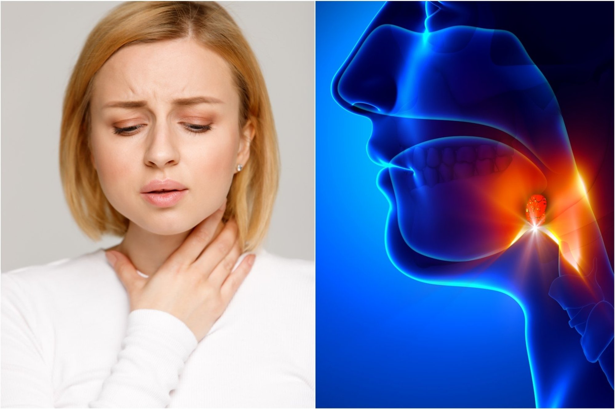 Atsakė, kada anginos operuoti nevertėtų: šalutinės pasekmės gali būti ...