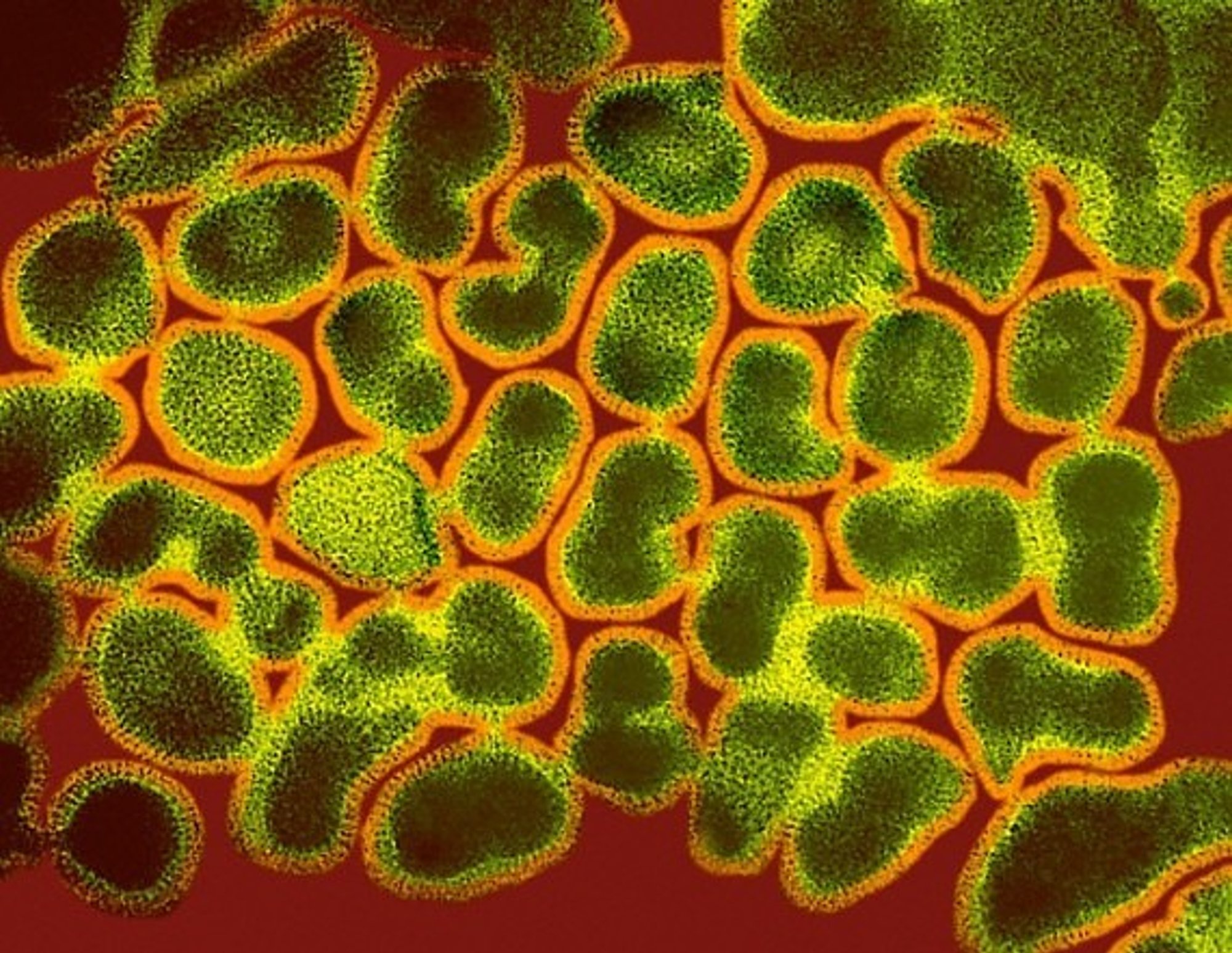 Virusas iš arčiau - Delfi