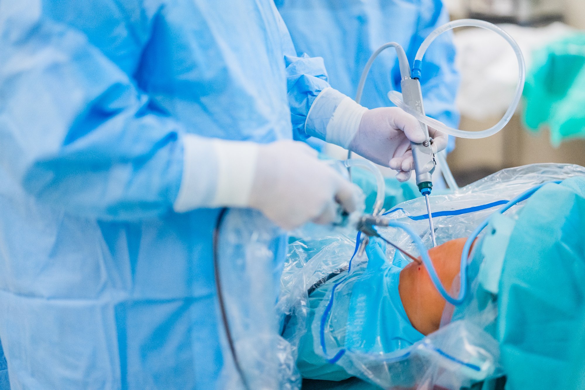 Plyšęs meniskas – ar tikrai visada būtina operuoti - Delfi užsakomasis ...