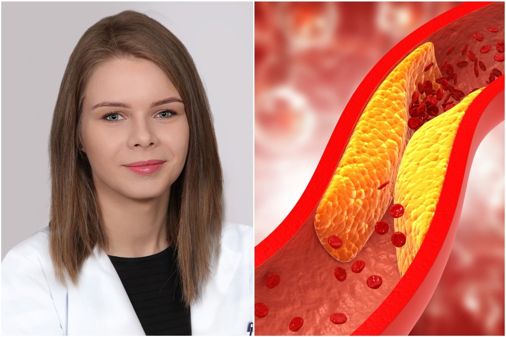 Problema – aukštas cholesterolis: dietologė pataria, kokie maisto ...