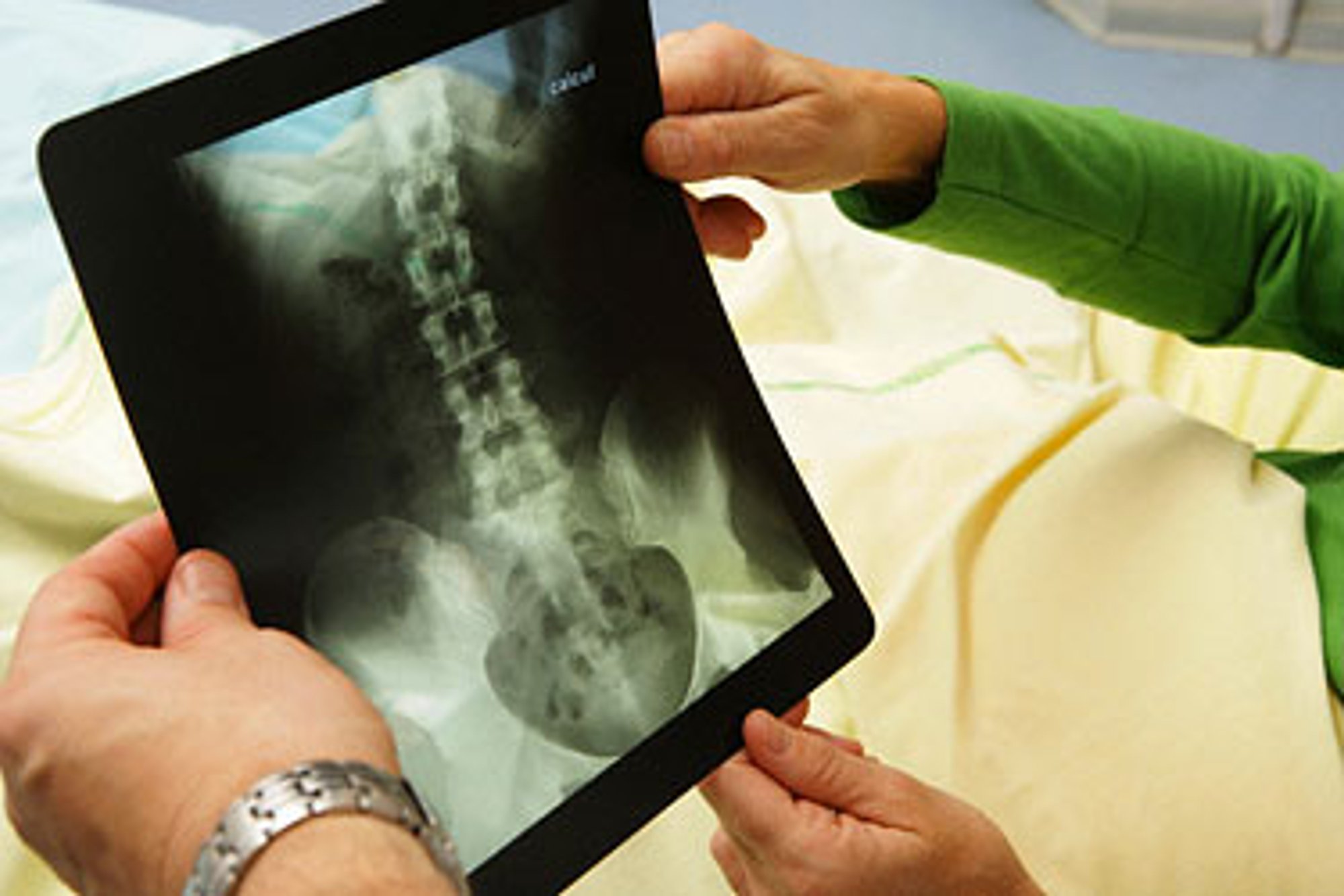 Stuburo iškrypimai – dažna vaikų bei paauglių liga - Delfi gyvenimas